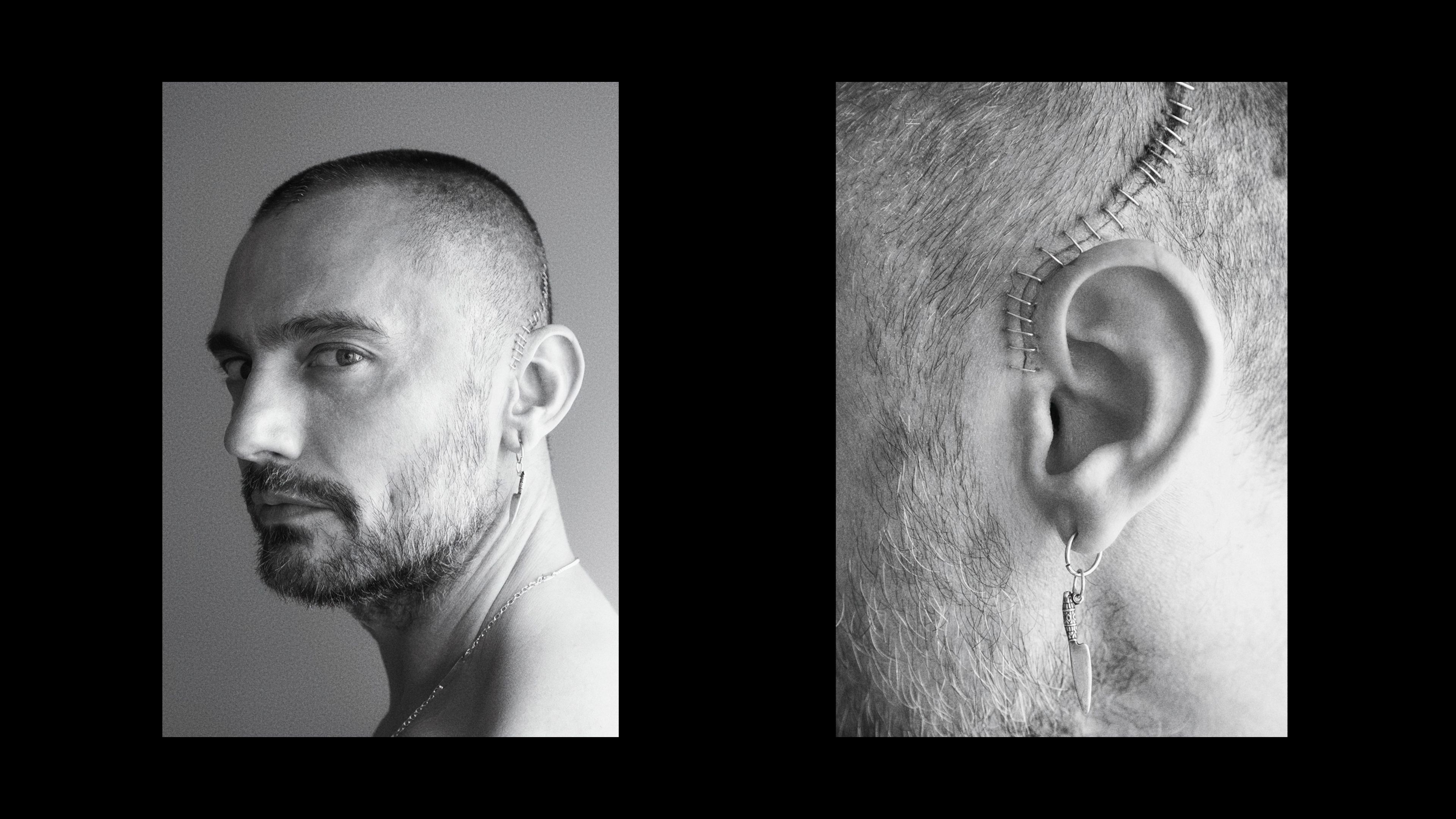 El significado de 'Muestra tu herida', el documental de David Delfín