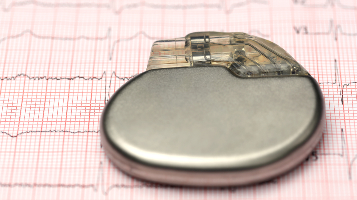 El marcapasos cumple 57 años - RTVE.es | RTVE