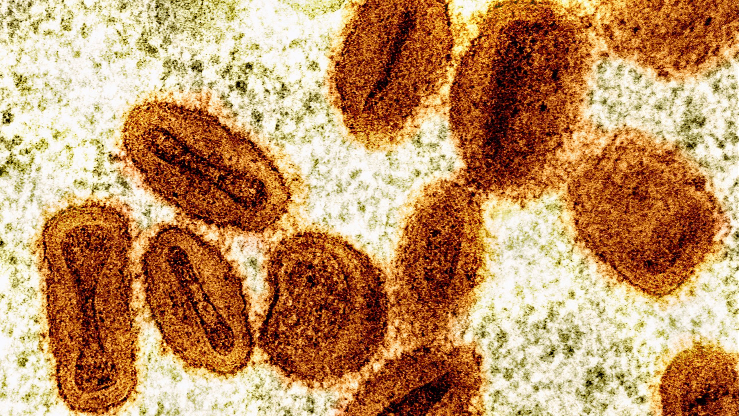 OMS levanta emergencia sanitaria internacional por la mpox